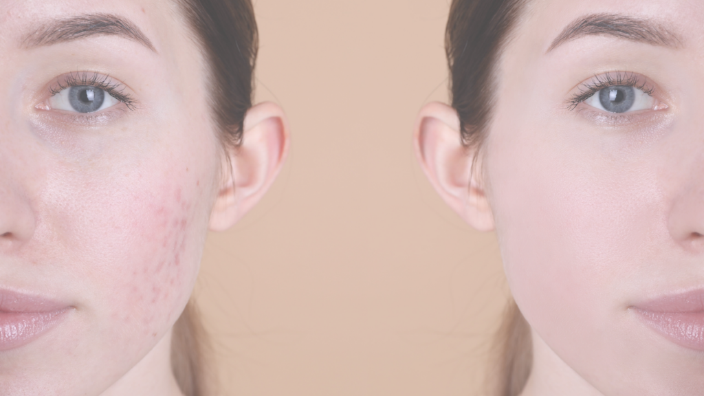 How to Use RxPhoto for Effective Before-and-After Comparisons